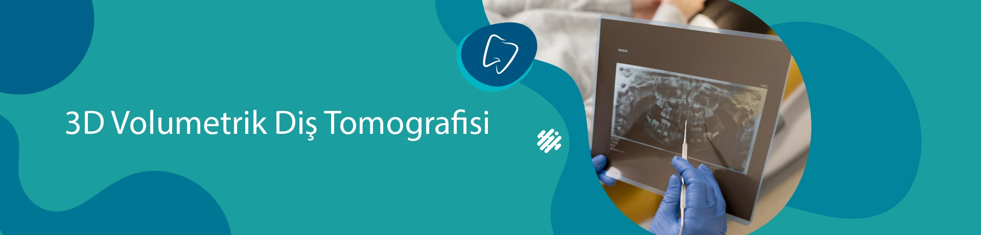 Esnan Dental Clinics | 3D Volumetrik Diş Tomografisi