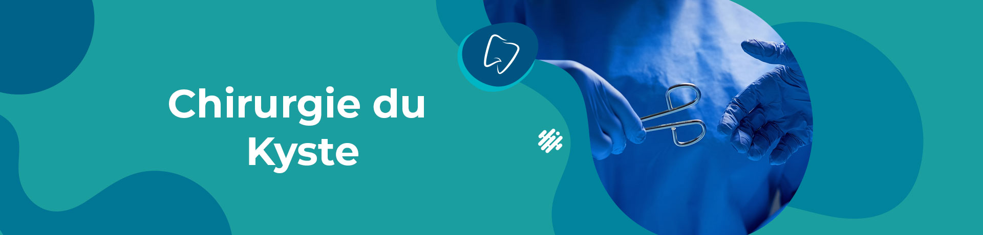 Esnan Dental Clinics | Chirurgie du Kyste