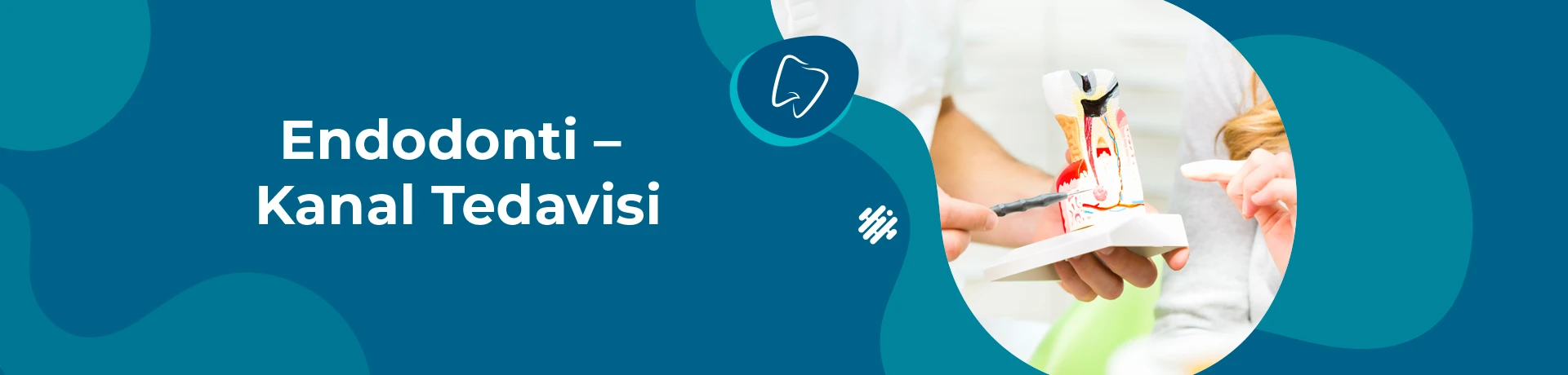 Esnan Dental Clinics | Endodonti - Kanal Tedavisi