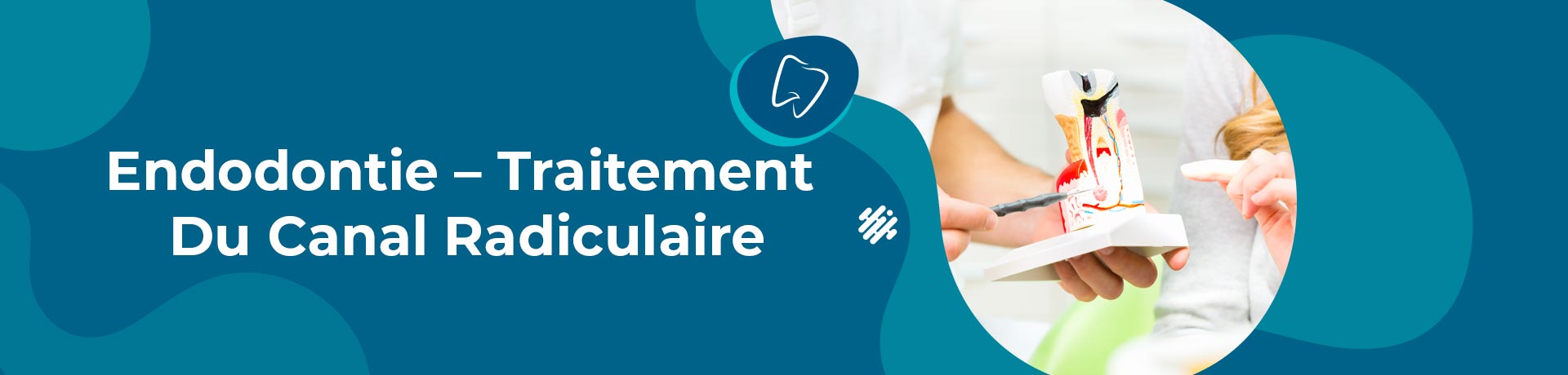 Esnan Dental Clinics | Endodontie - Traitement Du Canal Radiculaire
