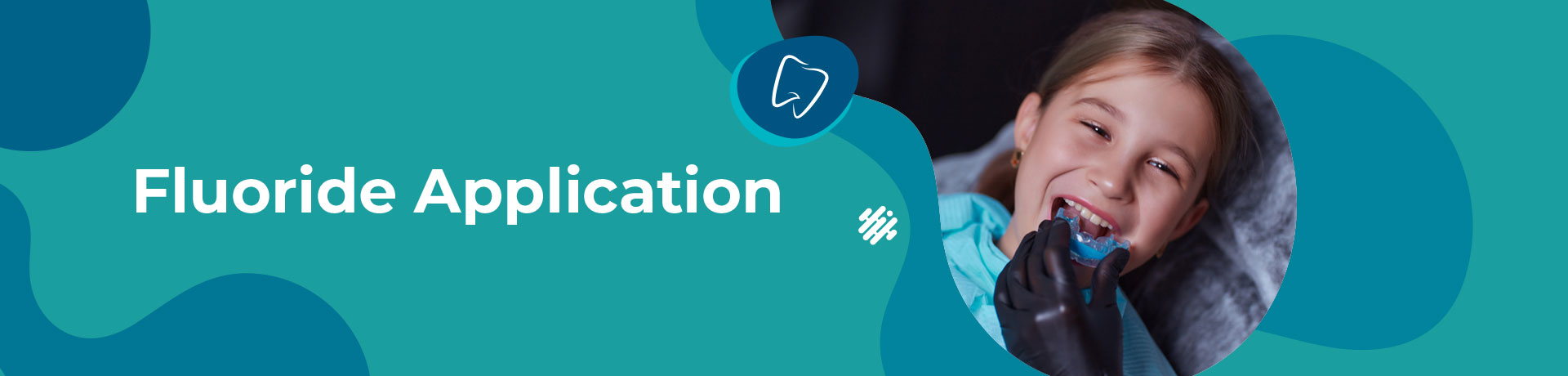 Fluoride Application | Dentists in Istanbul for Children