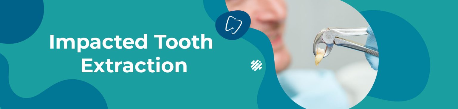 Esnan Dental Clinics | Impacted Tooth Extraction