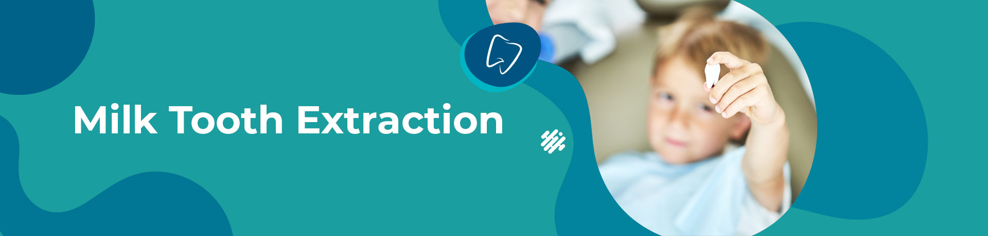 Milk Tooth Extraction | Pediatric Dentistry in Istanbul