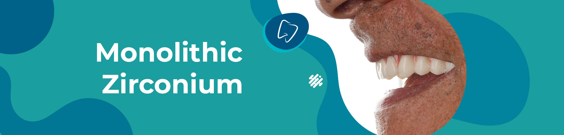 Monolithic Zirconium Veneers in Istanbul | Best Advantages