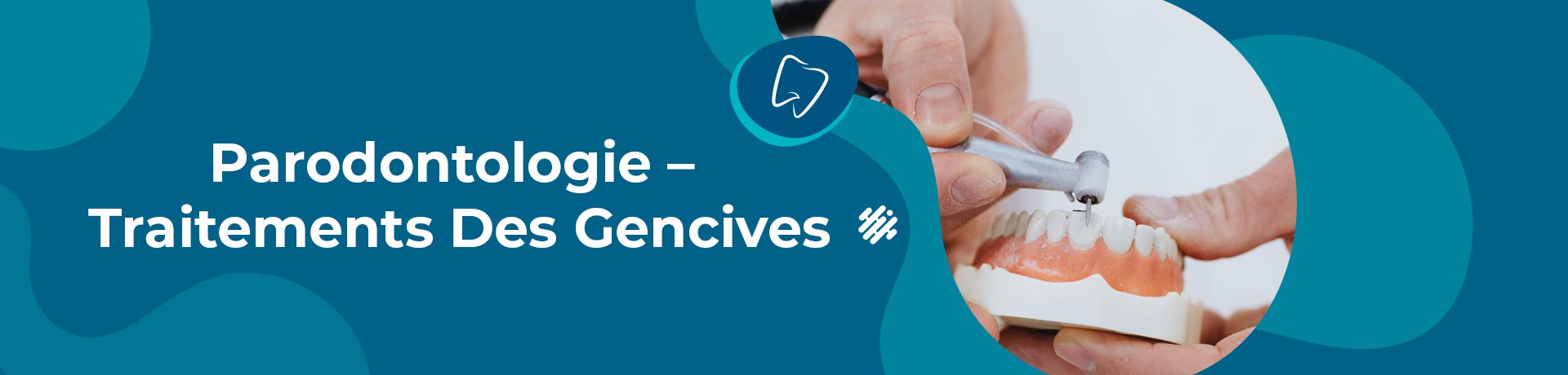 Esnan Dental Clinics | Parodontologie - Traitements Des Gencives