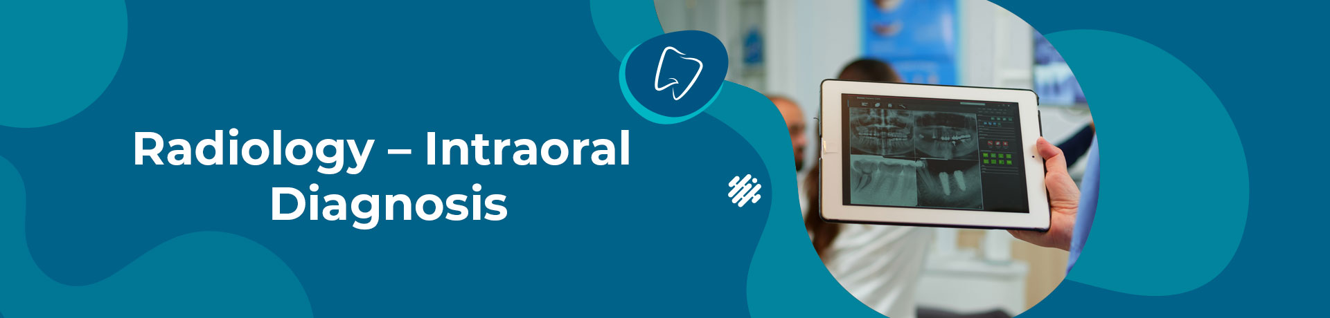 Intraoral Diagnosis: Essential Role in Dental Radiology