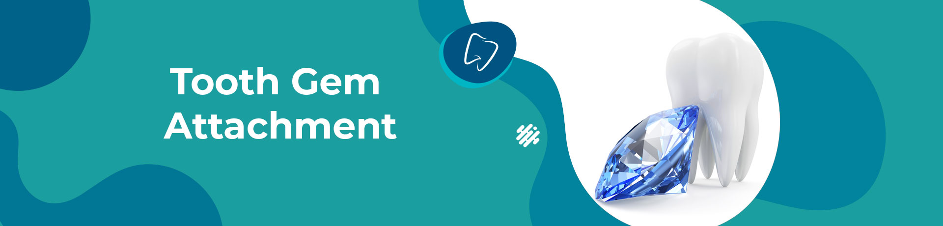Tooth Gem Attachment | Aesthetic Dentistry in Istanbul